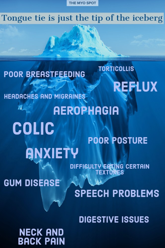 Tongue to Toes: The Whole Body Connection – Airway Matters