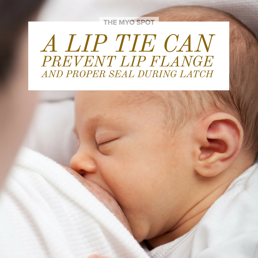 Myofunctional Therapy and Lip Ties: Advice for Every Age – Airway Matters