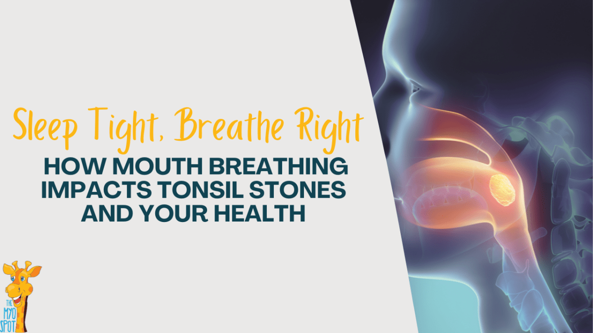 Find Natural Relief for Tonsil Stones with Myofunctional Therapy ...