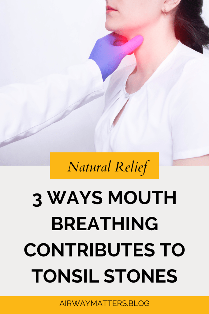 Find Natural Relief for Tonsil Stones with Myofunctional Therapy ...